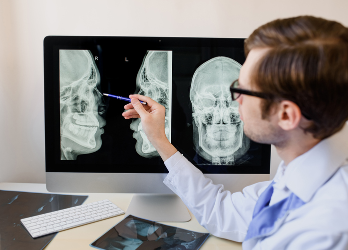 Understanding Car Accident Face Injuries: Are Your Glasses Putting You ...